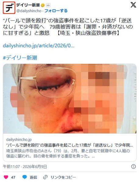 🚨【埼玉・狭山強盗致傷事件】バールで頭を殴打の強盗事件起こした17歳「逆送なし」で少年院へ 79歳被害者「謝罪・弁済がないのに甘すぎ ...